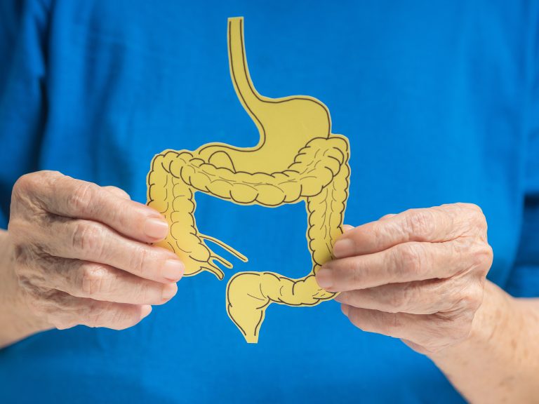 A Preventable Crisis: How Unrecognized Constipation Led to a ...
